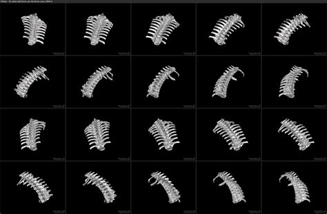 Anatomically Correct 3d Medical Reference Models 3d Thoracic Spine Model 3d Medical Model