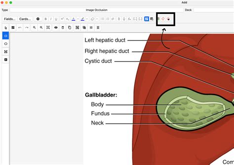 Anki Ai Image Occlusion