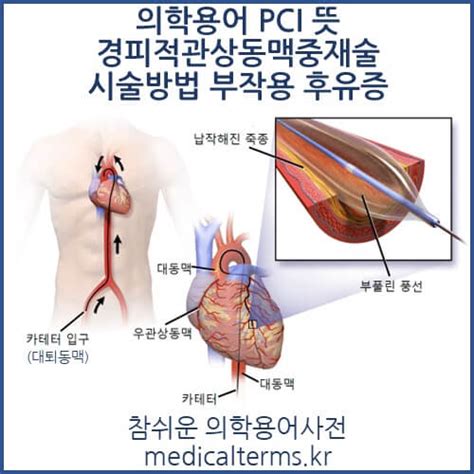 참쉬운 의학용어 참쉬운 의학용어사전