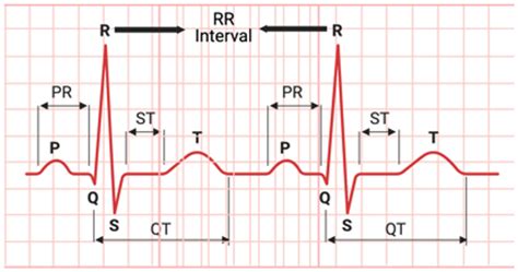 Arrhythmiaqtc Prolongation In Cardiotoxicity Springer Nature Link
