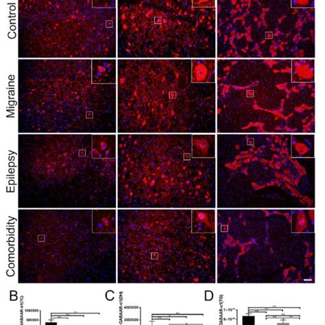 Localization Of Tlr4 In The Temporal Cortex Medullary Dorsal Horn And Download Scientific