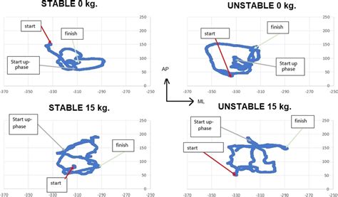 Cop Point To Point Plot Mm Movement In Ml X Axes Negative Numbers