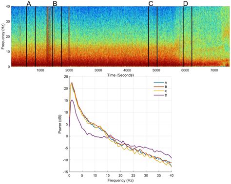 Spectrogram Top Section And Power Spectra Of The Electroencephalogram
