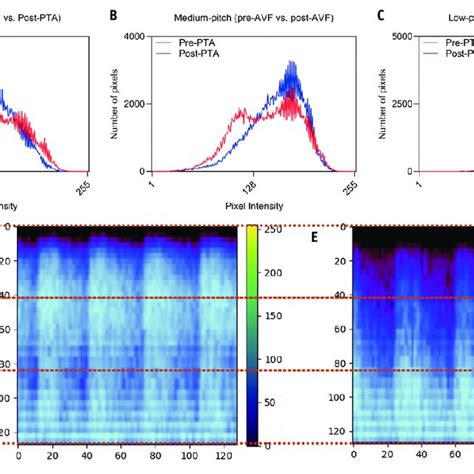 Histograms Showing The Number Of Pixels At Various Pixel Intensities At