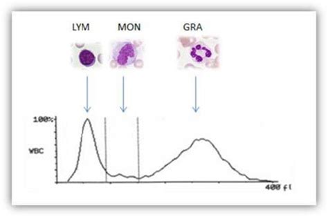 Wbc Histogram Pattern Contributes To Diagnostic Screening Of Malaria