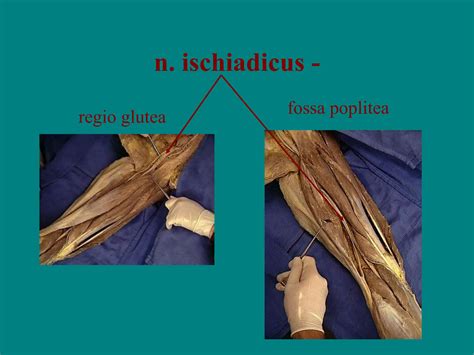 Dokumentipsnervi Donjeg Ekstremitetappt