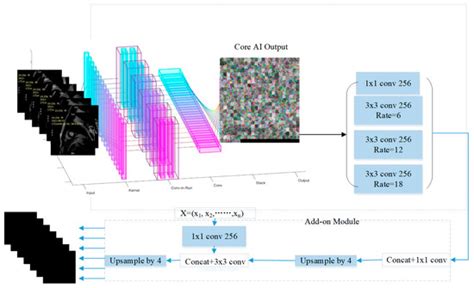 Myi Net Fully Automatic Detection And Quantification Of Myocardial Infarction From