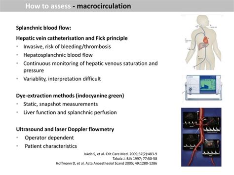 Monitoring Macro And Microcirculation Joel Starkopf Wsacs Session Esa