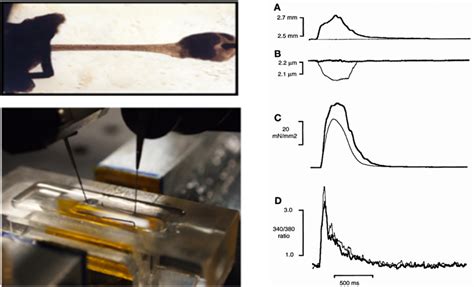 Cardiac Contractile Function Cardiaque At Phymedexp Phymedexp