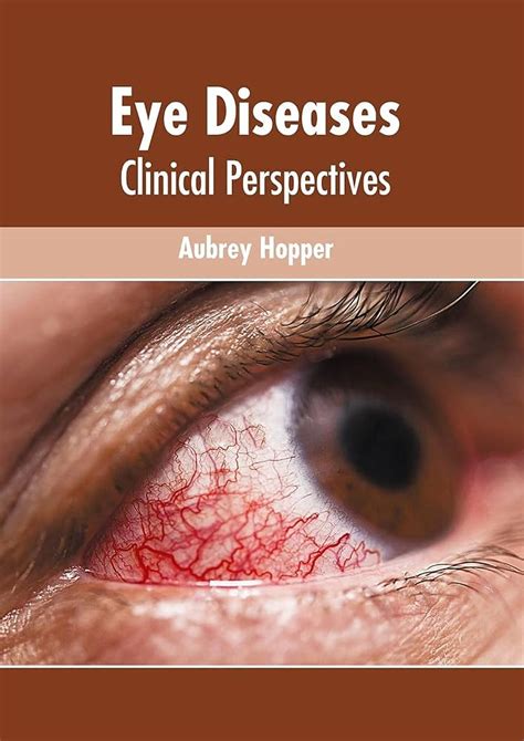 Eye Diseases Symptoms Treatments And Prevention Tips By