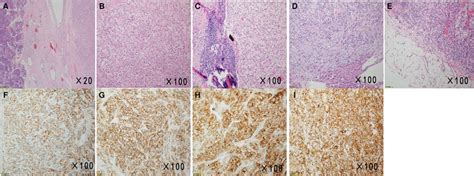 micrographs of the surgical specimens and immunohistochemical