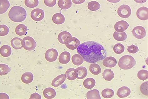 Wbc Differential Review University Quiz Quizizz