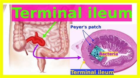Terminal Ileum Anatomy Stock Bowel Normal Anatomy — Illustrated