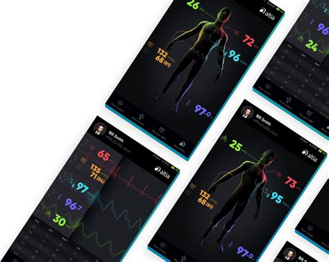Scalability For The STM32 Family Of Products Altia User Interface Design Tools And GUI Software