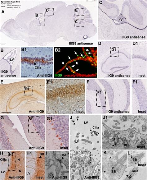 comparison between iiig9 mrna expression and protein localization in