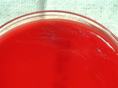 Free Picture Photograph Colonial Morphology Gram Negative Brucella Abortus Bacteria