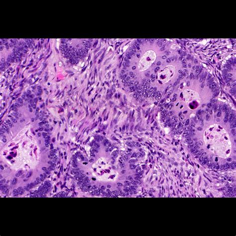 Biomedparse A Foundation Model For Joint Segmentation Detection And Recognition Of Biomedical