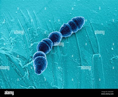 Streptococcus Pneumoniae Bacteria Coloured Scanning Electron Micrograph Sem This Bacterium