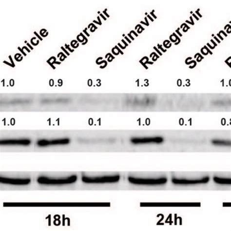 Hpv16 Positive Caski Cervical Cancer Cells Were Incubated In The