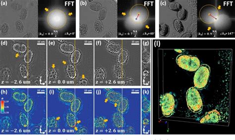 Figure 2 From High Resolution 3d Refractive Index Microscopy Of