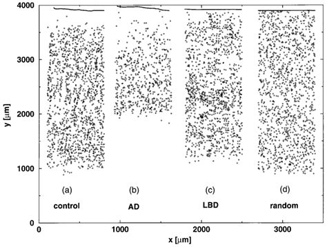 A Typical Example Of Distribution Of Neurons In A Tissue Sample Of A