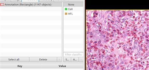 Question About Using Qupath Script To Detect Cells Image Analysis Imagesc Forum