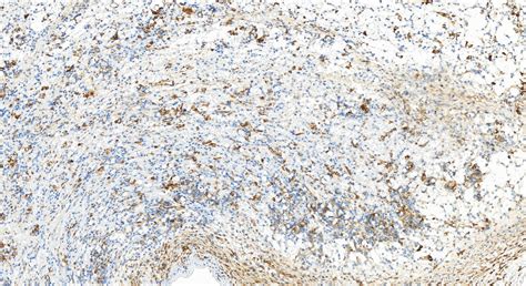 Integrin Beta 5 Antibody 83514 3 Rr Proteintech