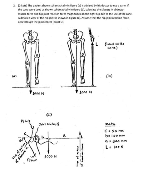 solved 2 24 pts the patient shown schematically in figure