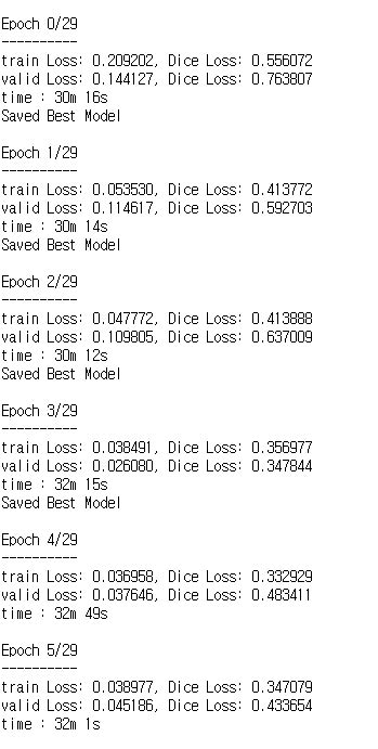 Unbalanced Data Overfitting Occurs Pytorch Forums
