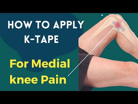 How To Tape A Knee Acl Anterior Cruciate Ligament Sprain Sports Taping Series