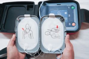 AED Pad Placement A Step By Step Guide For Effective Use