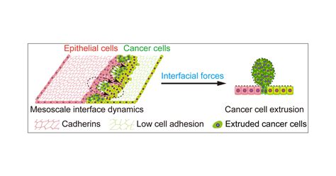 Interfacial Organization And Forces Arising From Epithelialcancerous