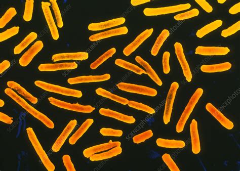 Lactobacillus Bacterial Cells Stock Image B2200882 Science Photo Library