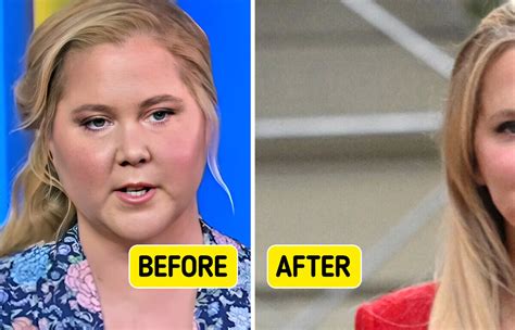 “looked Better Before ” Amy Schumer Unrecognizable After Major Body