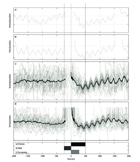 Video Oculography Findings Of The Right Eye During The First Session Download Scientific