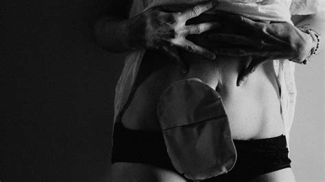 Ostomy Procedure Aftercare Duration And More