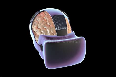 3d Illustration Of A Human Brain Wearing Vr Glasses Symbolizing Virtual Reality Impact On