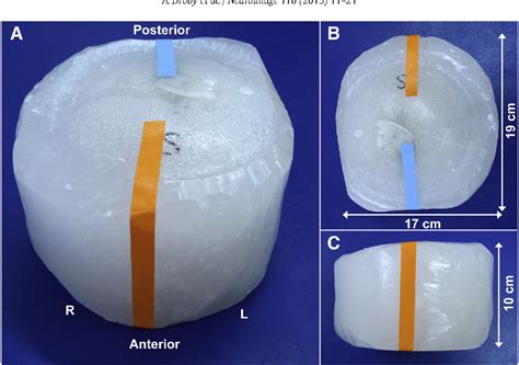 Figure 1 From A Human Post Mortem Brain Model For The Standardization Of Multi Centre Mri