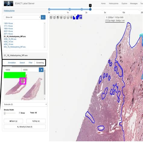 Left Five Examples Of Plugins From Top To Bottom The Image Filter Download Scientific