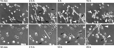 Time Lapse Sequences Of The Heterogenous Hcec Population Hcec 12 On