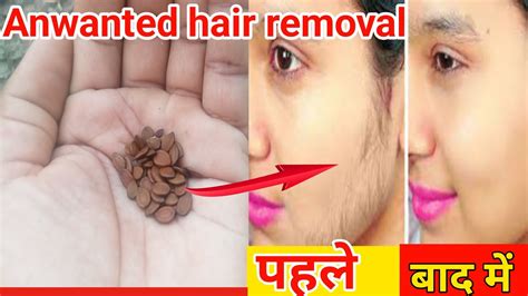 What Is The Benefit Of Subabul Seed Is Subabul Tree Used For Paper Is