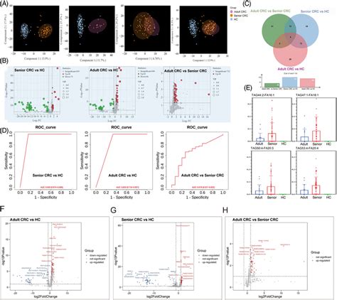 The Lipidomics Results Of Colorectal Cancer Crc A Orthogonal