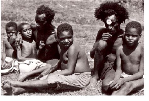 Figure 9 From Kuru The First Human Prion Disease Semantic Scholar