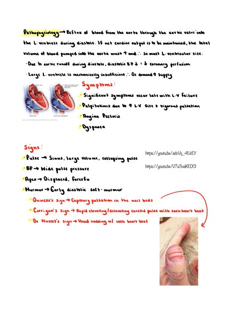 Aortic Regurgitation Youtuadcvq4lkey Youtuv7u3vakedci