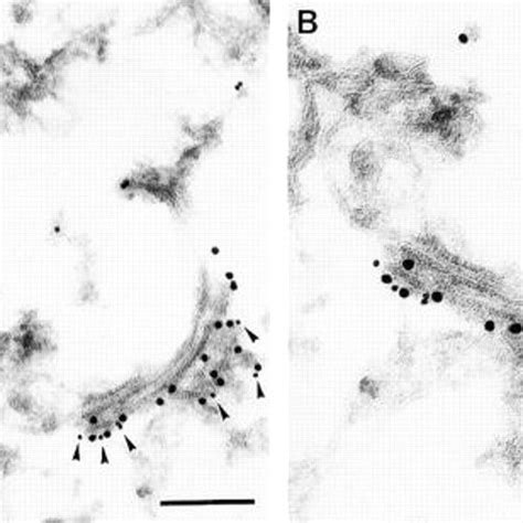 Immunoelectron Microscopic Localization Of Caveolin In Golgi Fractions Download Scientific