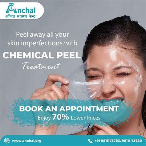 Unveil Your Best Skin With A Chemical Peel Treatment In Vaishali