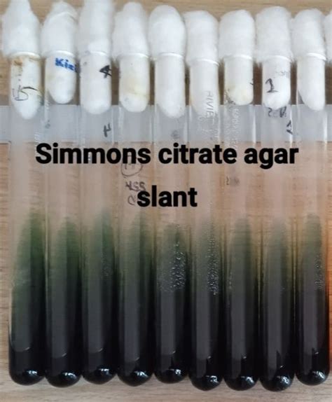 Citratetest Differentiatingbacteria Metabolicinsights Microbiology Clinicalmicrobiology
