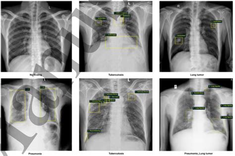 samples of the dataset with abnormalities enclosed in download