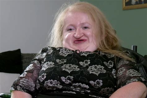 Disabled People Have Sex Why Cant The Nhs Understand That The