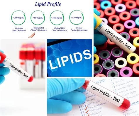 Lipid Profile Test Hyperlipidemia Causes Cholesterol Sources And Importance Science Online